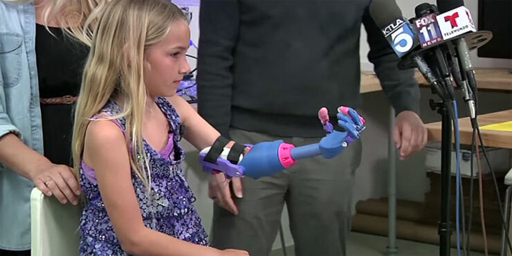 7-Year-Old Girl Gets 3D Printed 'Robohand'