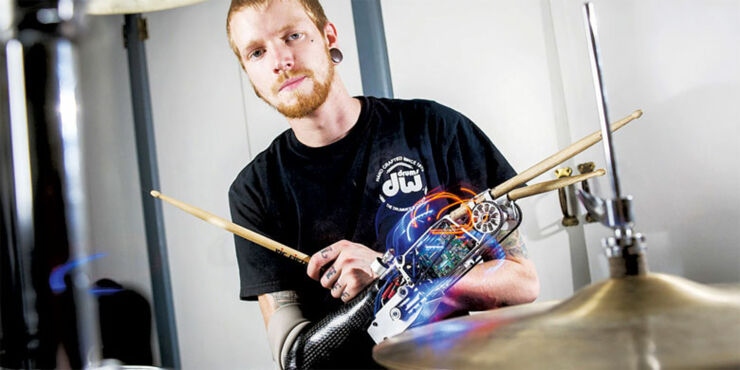 Cyborg Drummer Jason Barnes Has A Bionic Arm